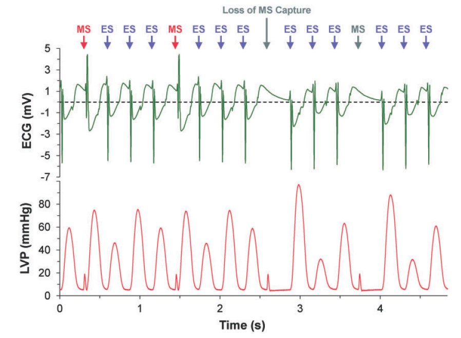 QT Service Using Langendorff Perfused Heart - Creative Bioarray