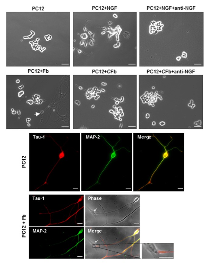 Cultured Neuronal Cell Lines - Creative Bioarray