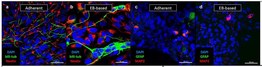 Isolation and culture of neural stem/progenitor cells - Creative Bioarray