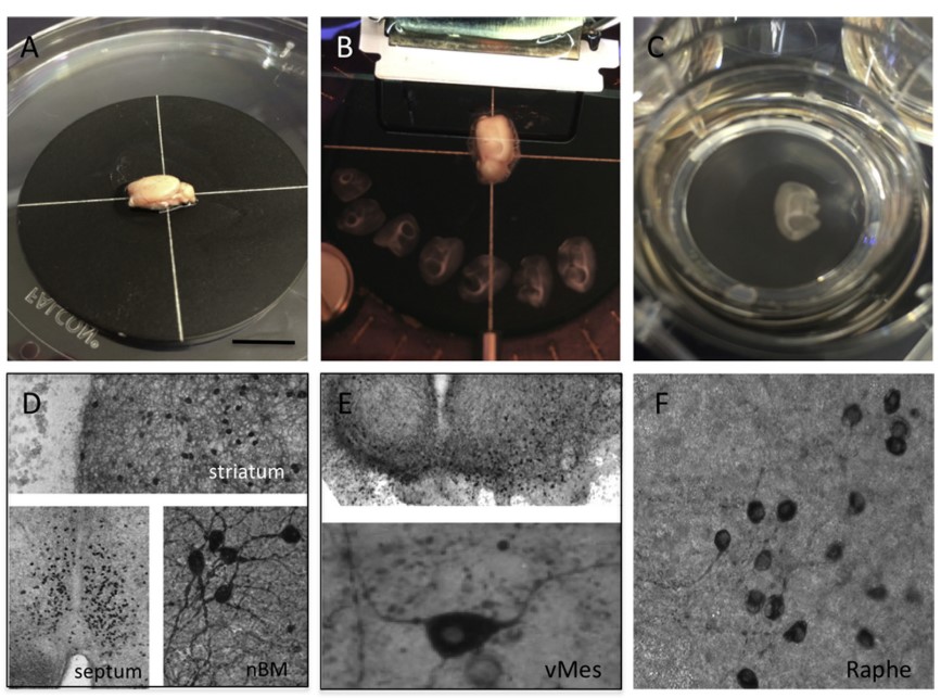 Acute/Cultured Organotypic Brain Slices - Creative Bioarray