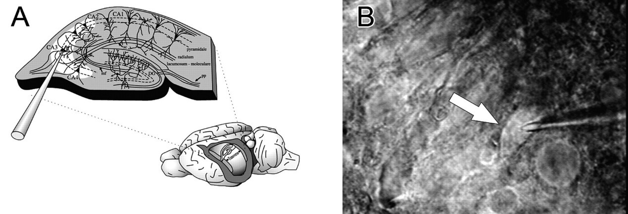 Acute/Cultured Organotypic Brain Slices - Creative Bioarray