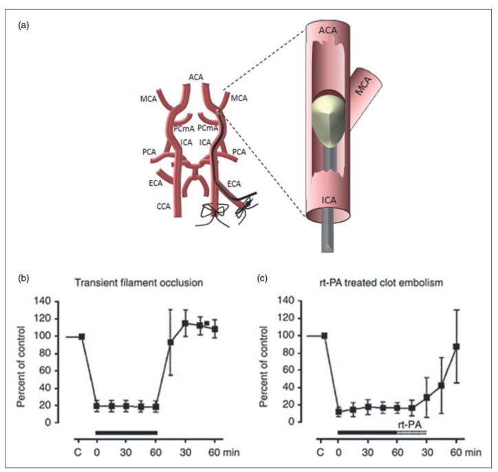 Stroke Model - Creative Bioarray